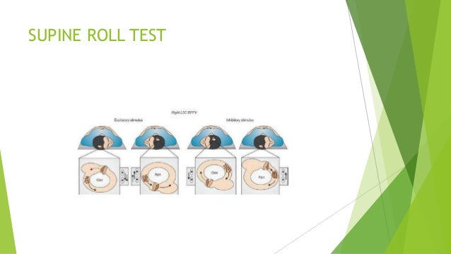Clinical examination of vertigo