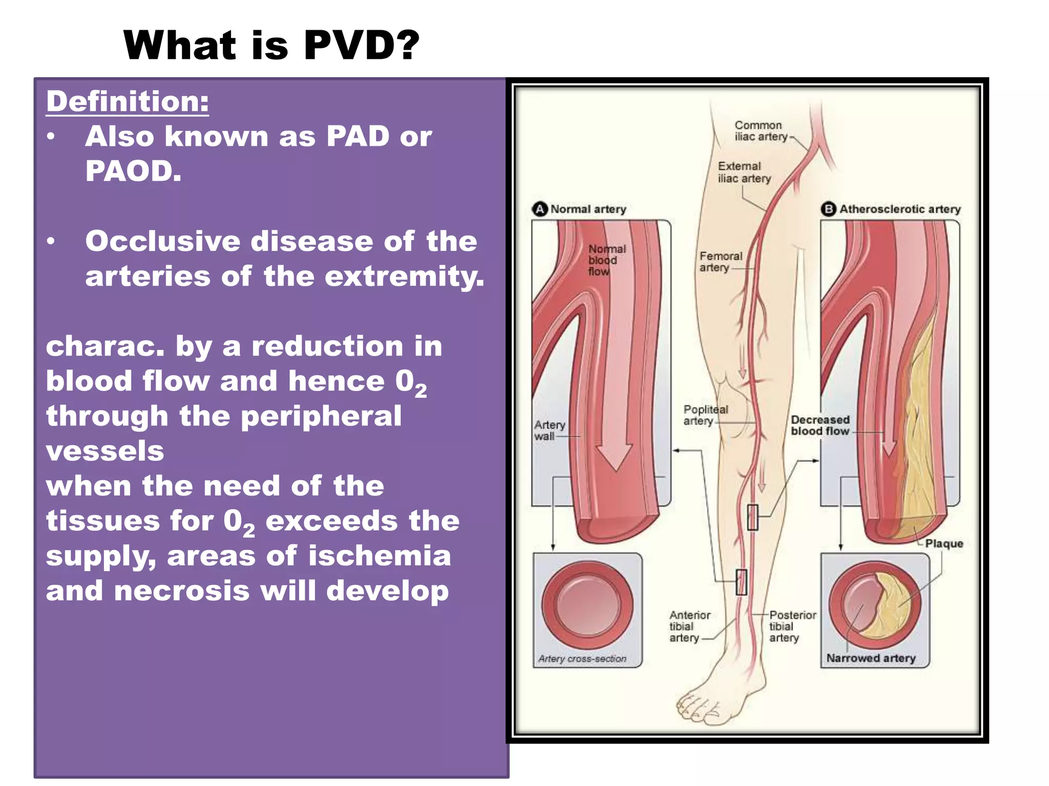 Clinical examination peripheral vascular disease | PPTX