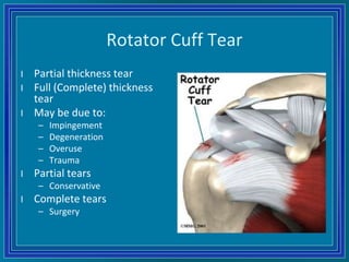 Clinical_Examination_Shoulder (2).ppt