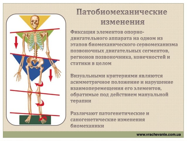 clinical_example_impaired_posture_pps_np
