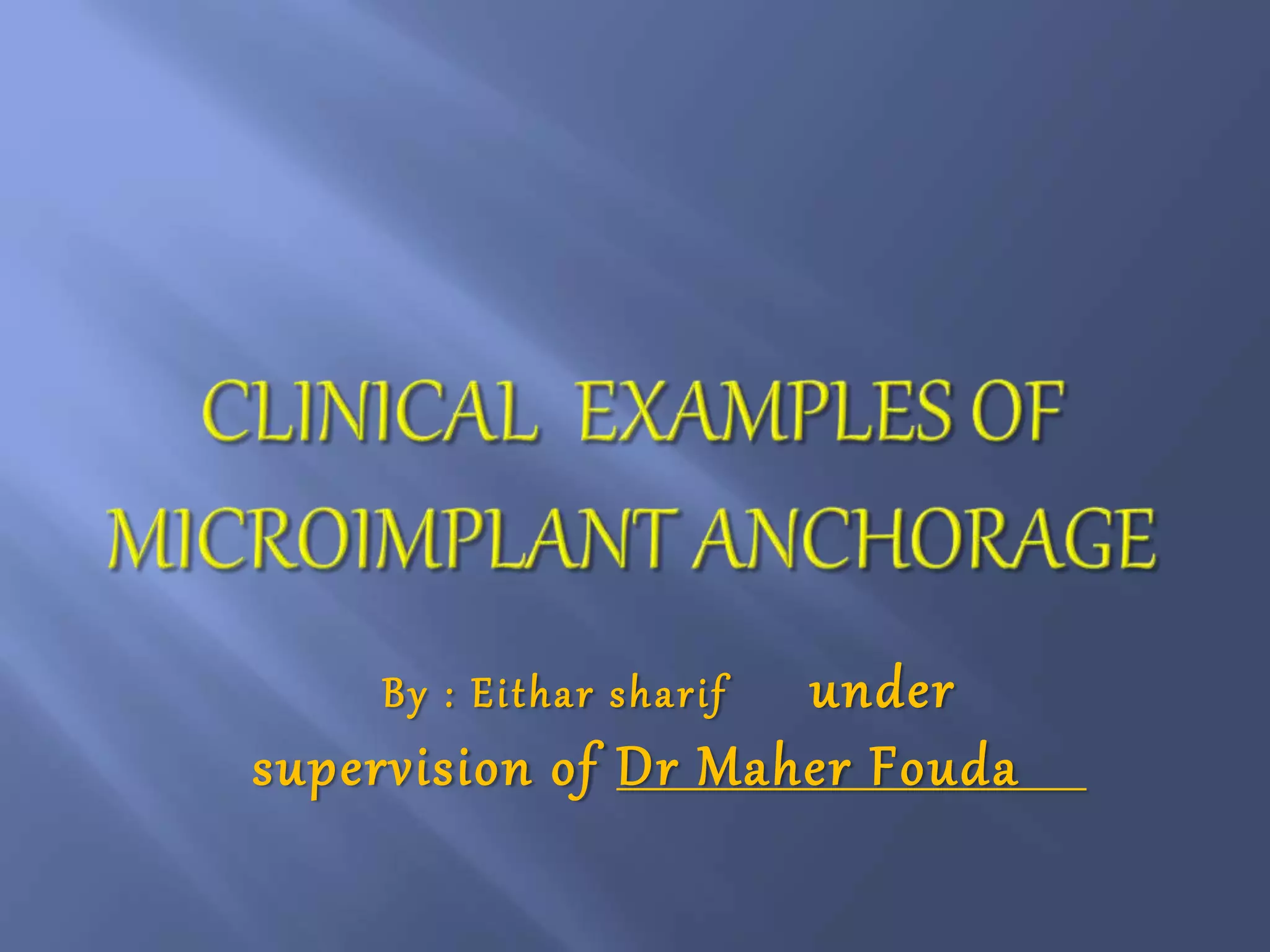 Clinical examples of microimplant anchorage | PPTX