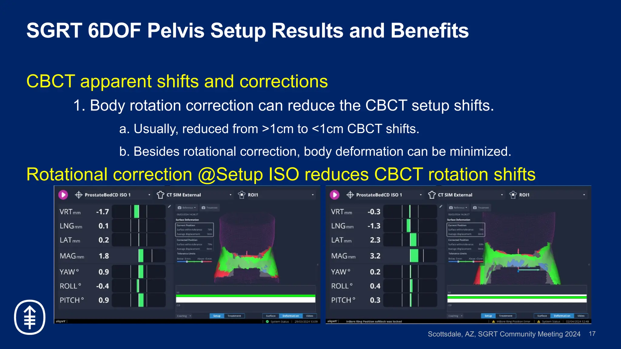 Clinical Experience with SGRT Applications for Bore-based Systems | PDF