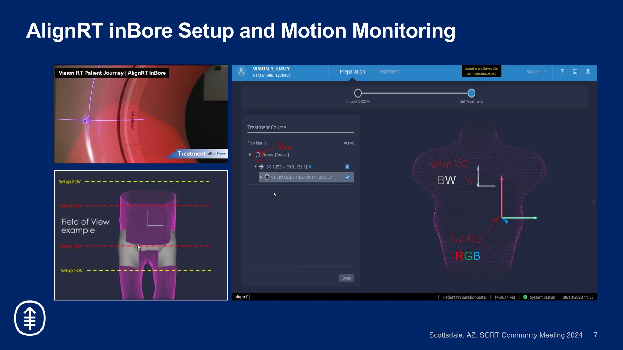 Clinical Experience with SGRT Applications for Bore-based Systems | PDF