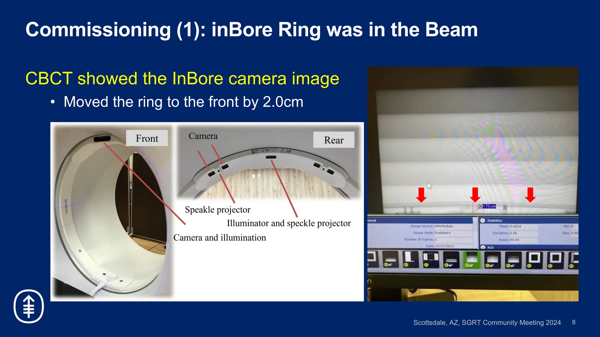 Clinical Experience with SGRT Applications for Bore-based Systems | PDF