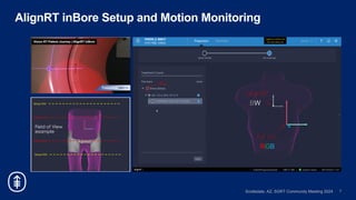 Clinical Experience with SGRT Applications for Bore-based Systems | PDF
