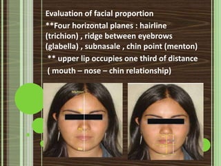 Clinical extraoral examination | PPTX