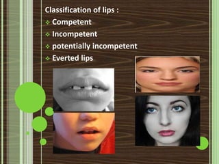 Clinical extraoral examination | PPTX