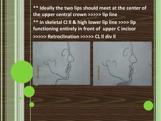 Clinical extraoral examination | PPTX