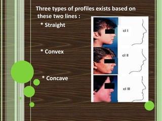 Clinical extraoral examination | PPTX