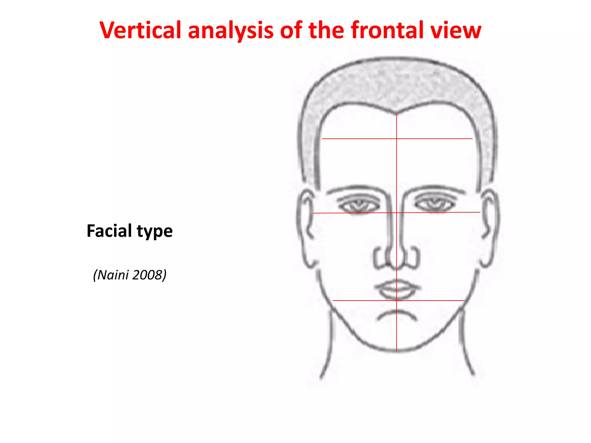 Clinical facial analysis (cfa) for orthodontists | PPTX
