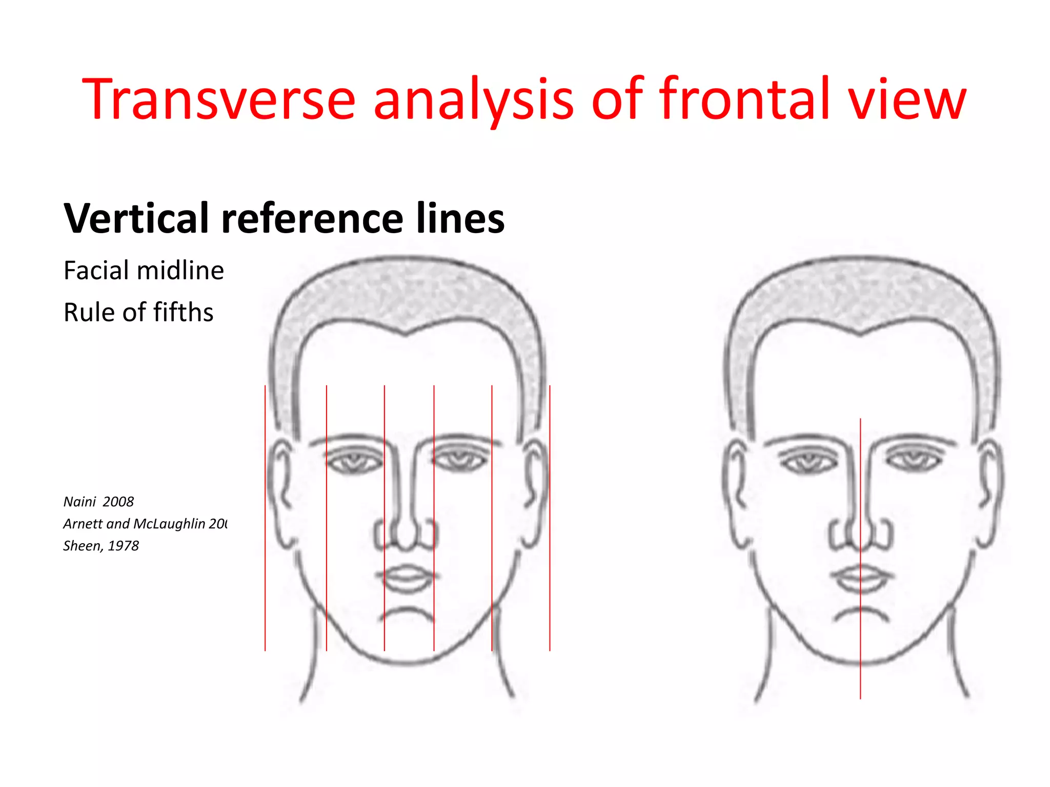 Clinical facial analysis (cfa) for orthodontists | PPTX
