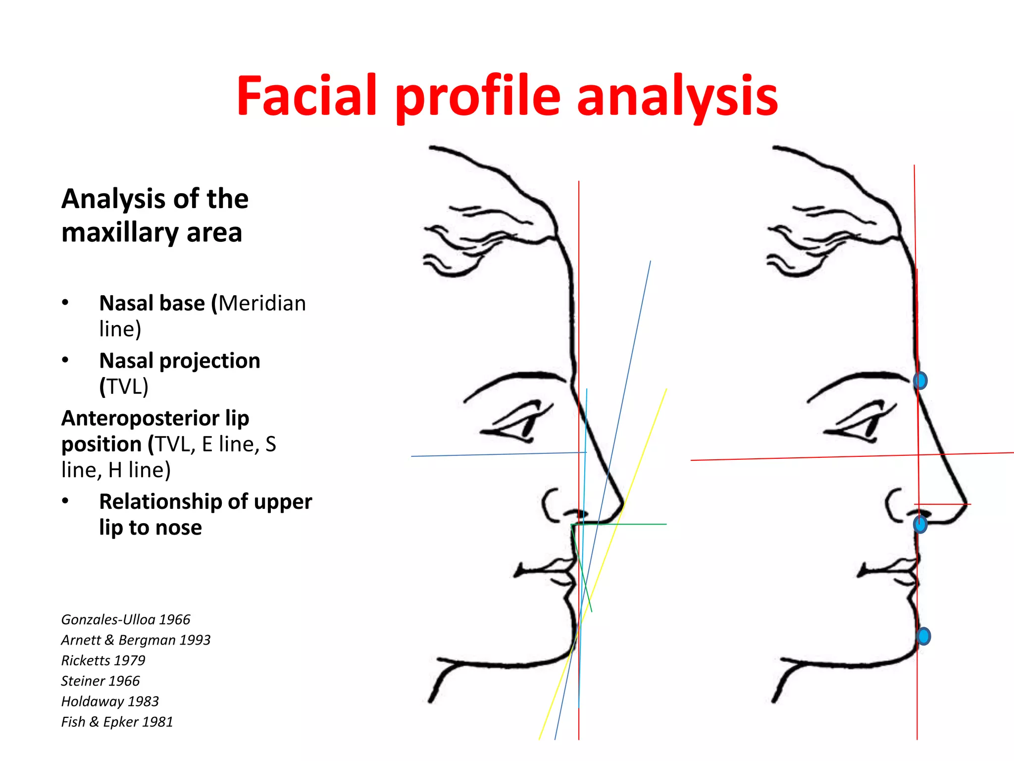 Clinical facial analysis (cfa) for orthodontists | PPTX