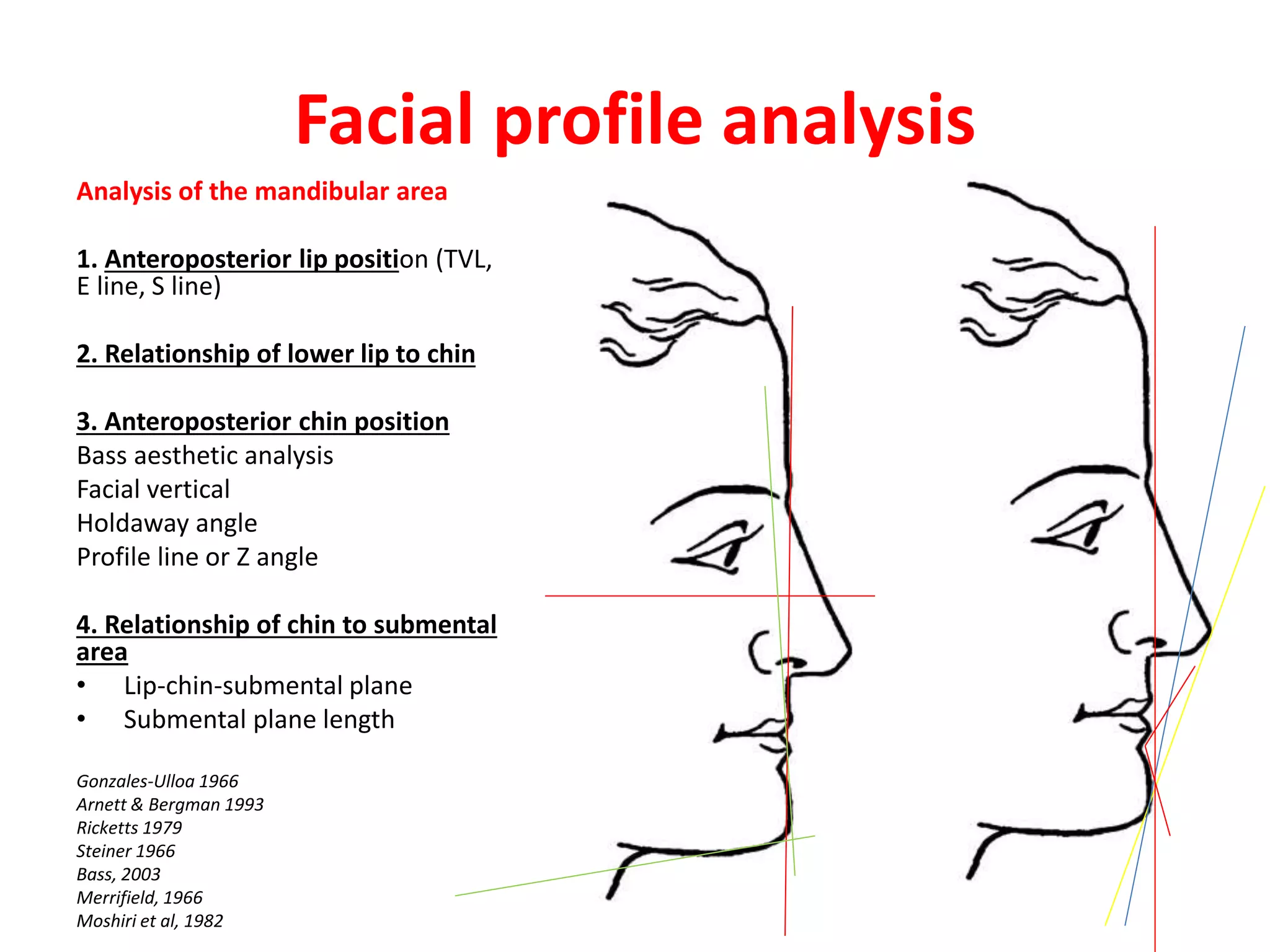 Clinical facial analysis (cfa) for orthodontists | PPTX