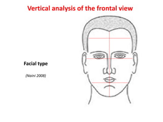 Clinical facial analysis (cfa) for orthodontists | PPTX