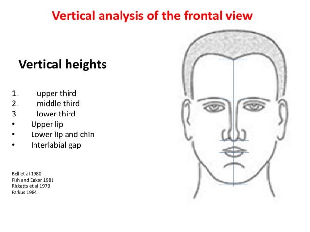 Clinical facial analysis (cfa) for orthodontists | PPTX | Dental Health ...