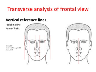 Clinical facial analysis (cfa) for orthodontists | PPTX | Dental Health ...
