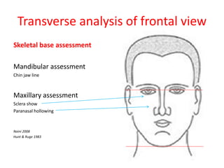 Clinical facial analysis (cfa) for orthodontists | PPTX