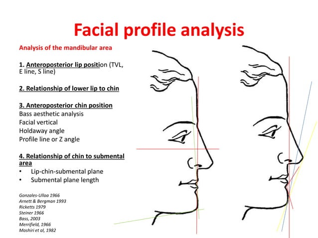 Clinical facial analysis (cfa) for orthodontists