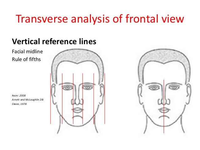 Clinical facial analysis (cfa) for orthodontists