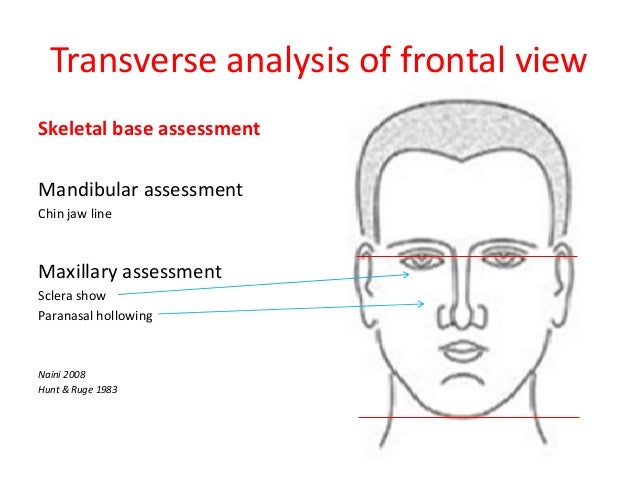 Clinical facial analysis (cfa) for orthodontists