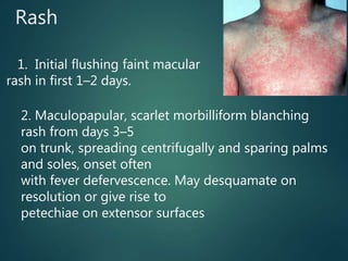 Clinical feature and diagnosis of japanese encephalitis and dengue (1 ...