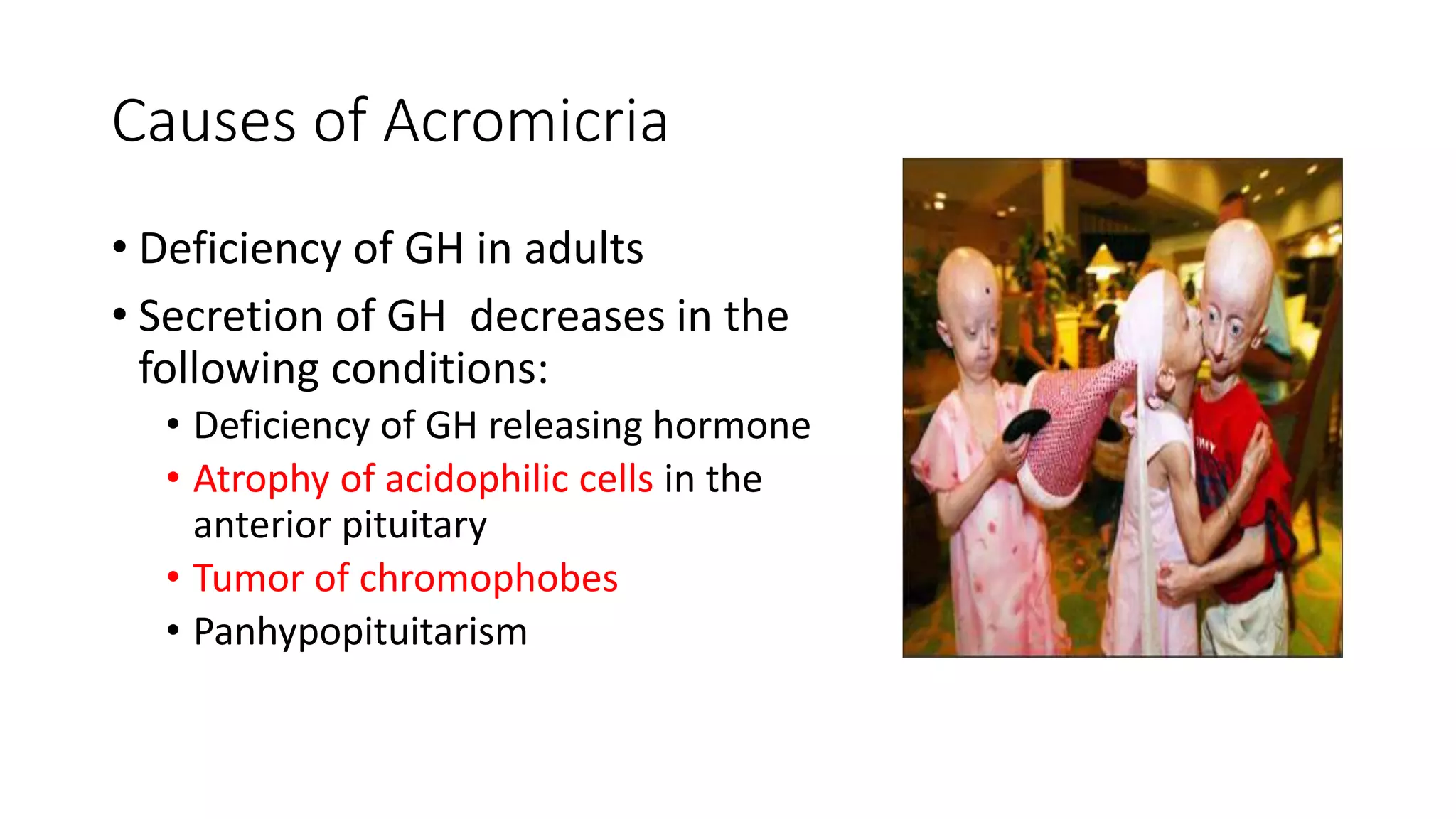 Clinical feature of ant. pituitary gland | PPTX