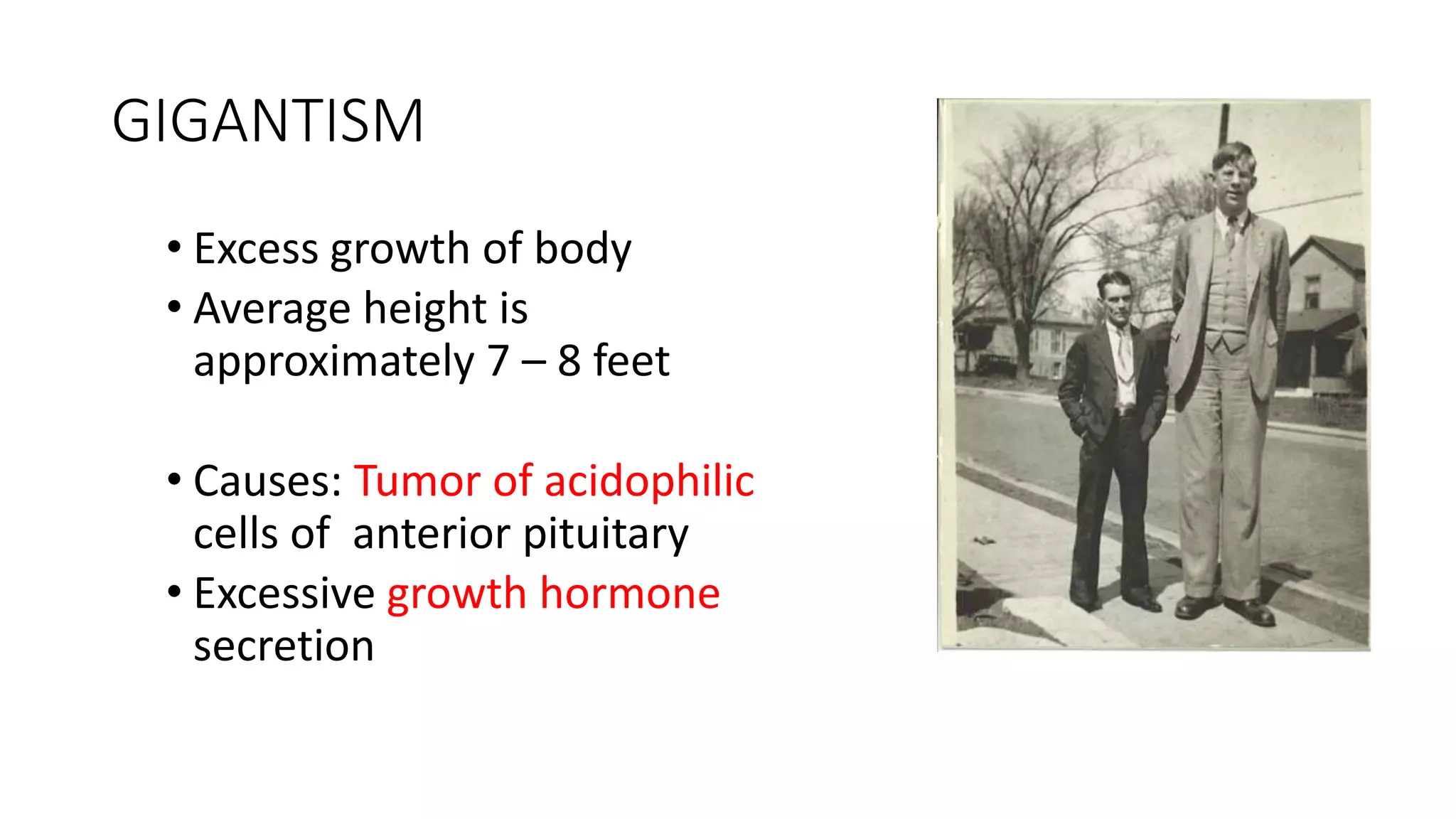 Clinical feature of ant. pituitary gland | PPTX