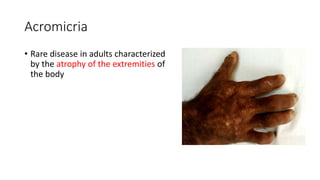 Clinical feature of ant. pituitary gland | PPT