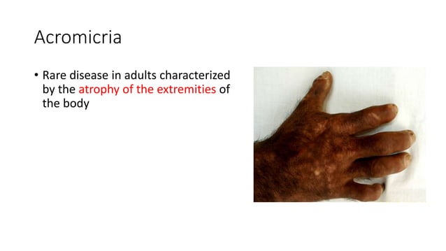 Clinical feature of ant. pituitary gland | PPT