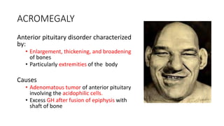 Clinical feature of ant. pituitary gland | PPT