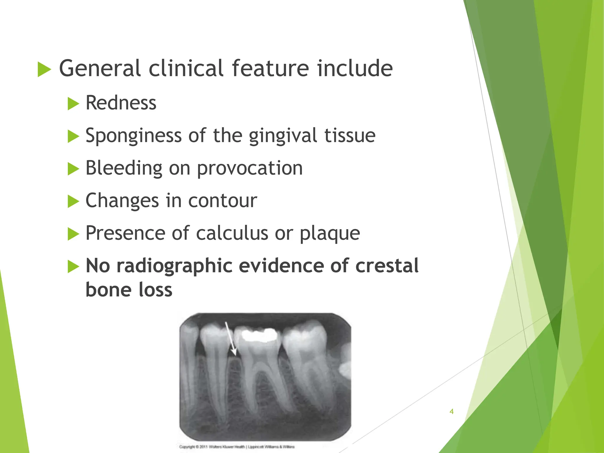 clinical feature of gingivitis (1).pptx | Dental Health | Diseases and ...