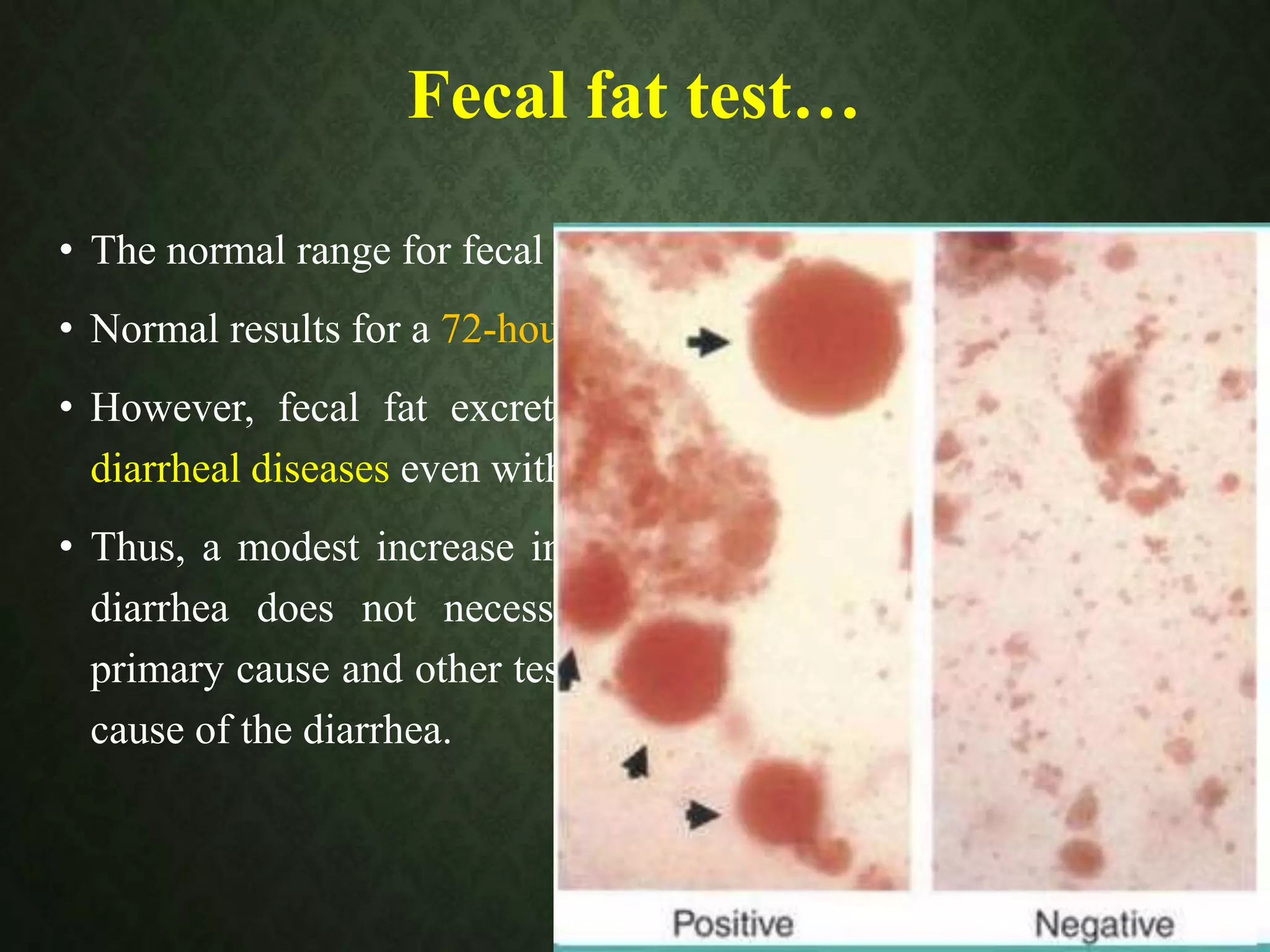 Clinical features and diagnosis of malabsorption | PPTX