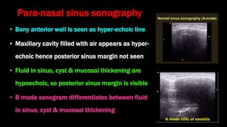 Clinical features and diagnosis of rhinosinusitis | PPT