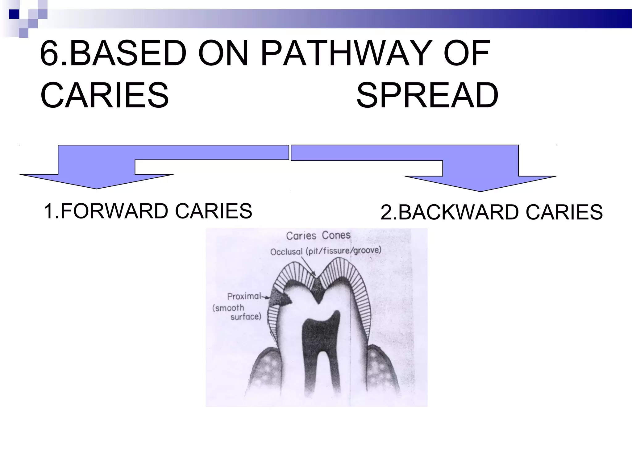 Clinical features and histopathology of dental caries | PPT