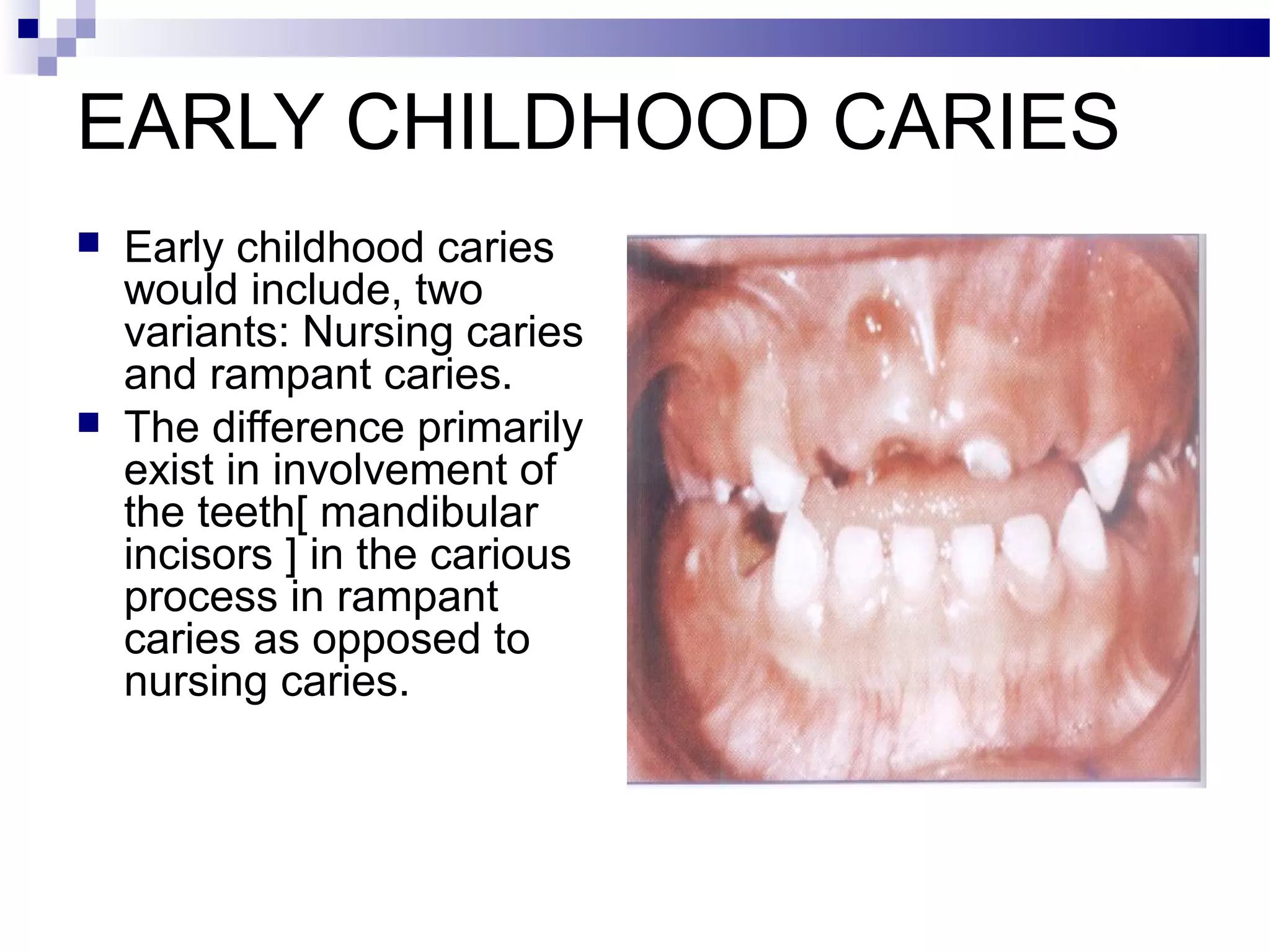 Clinical features and histopathology of dental caries | PPT
