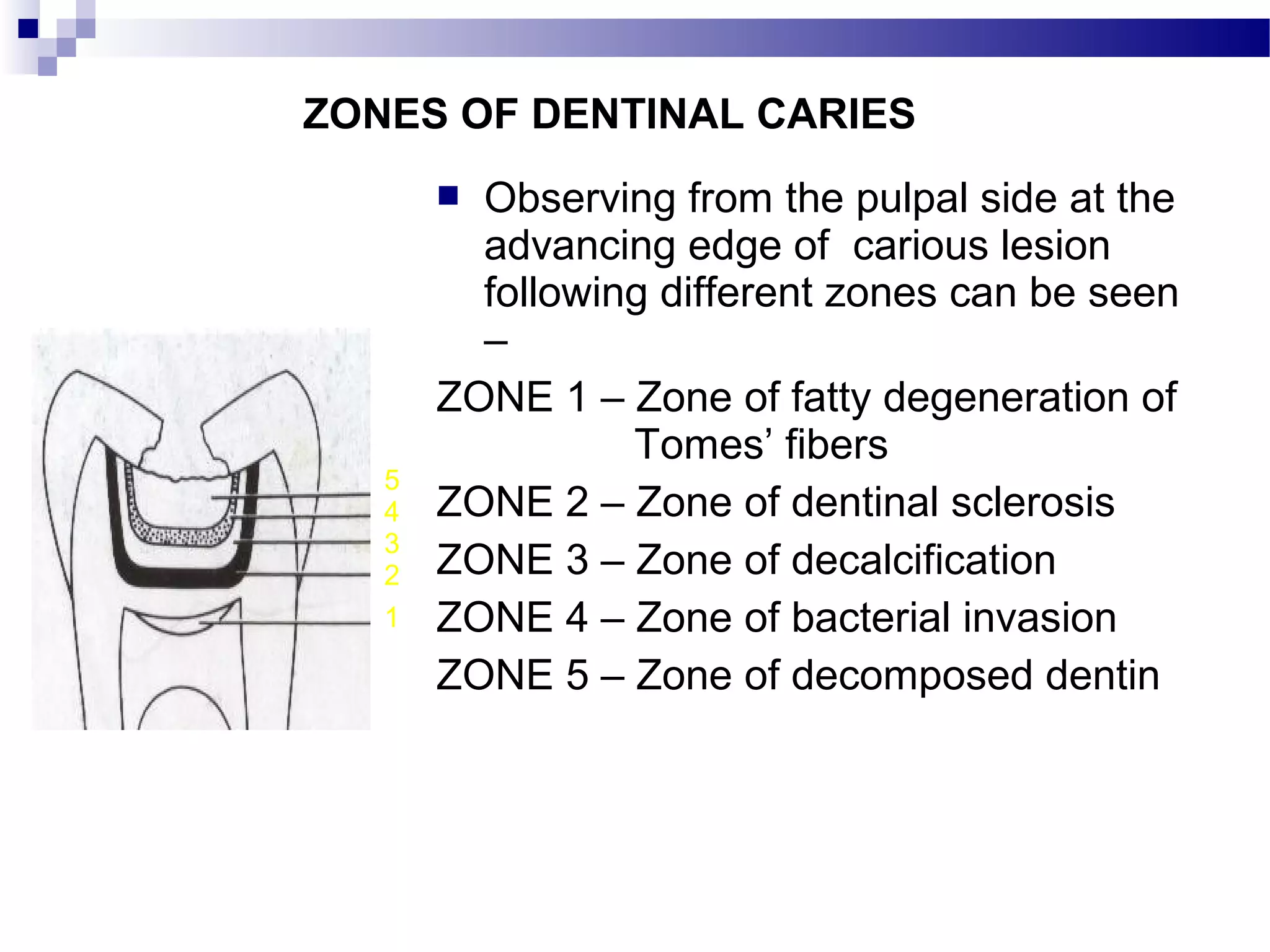 Clinical features and histopathology of dental caries | PPT