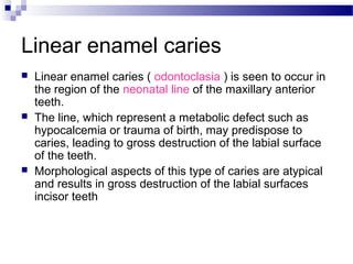 Clinical features and histopathology of dental caries | PPT