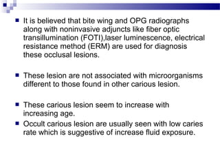 Clinical features and histopathology of dental caries | PPT