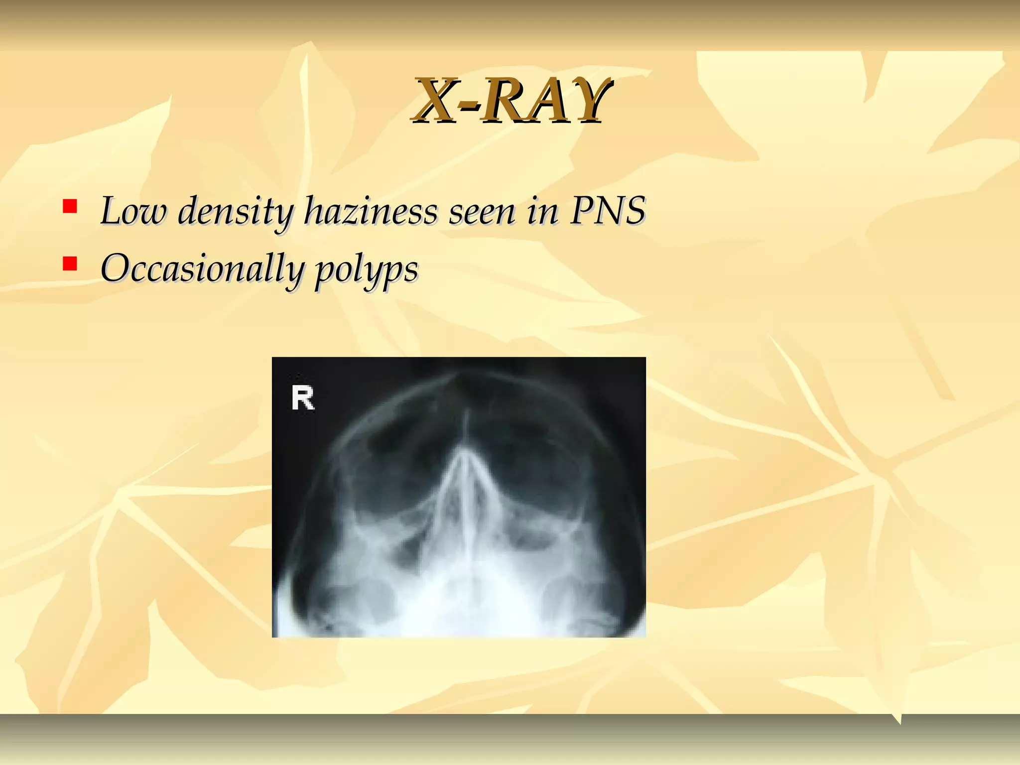Clinical features and investigations of allergic rhinitis | PPT