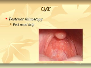 Clinical features and investigations of allergic rhinitis | PPT