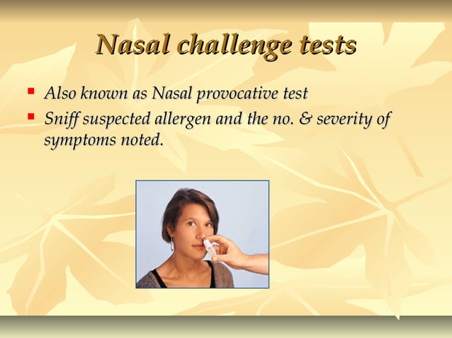 Clinical features and investigations of allergic rhinitis | PPT