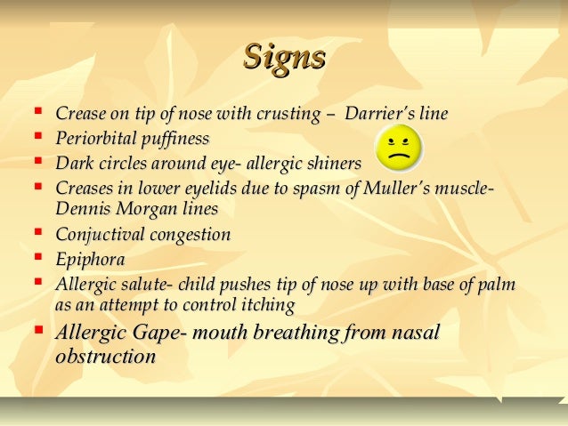 Allergic salute - villatews