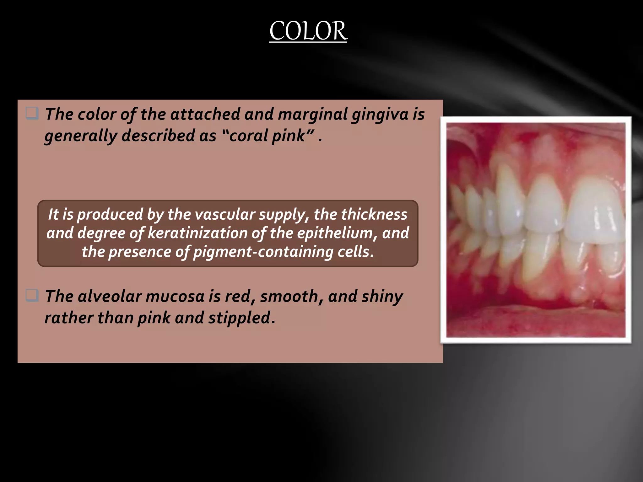 Clinical features and stages of gingivitis | PPTX