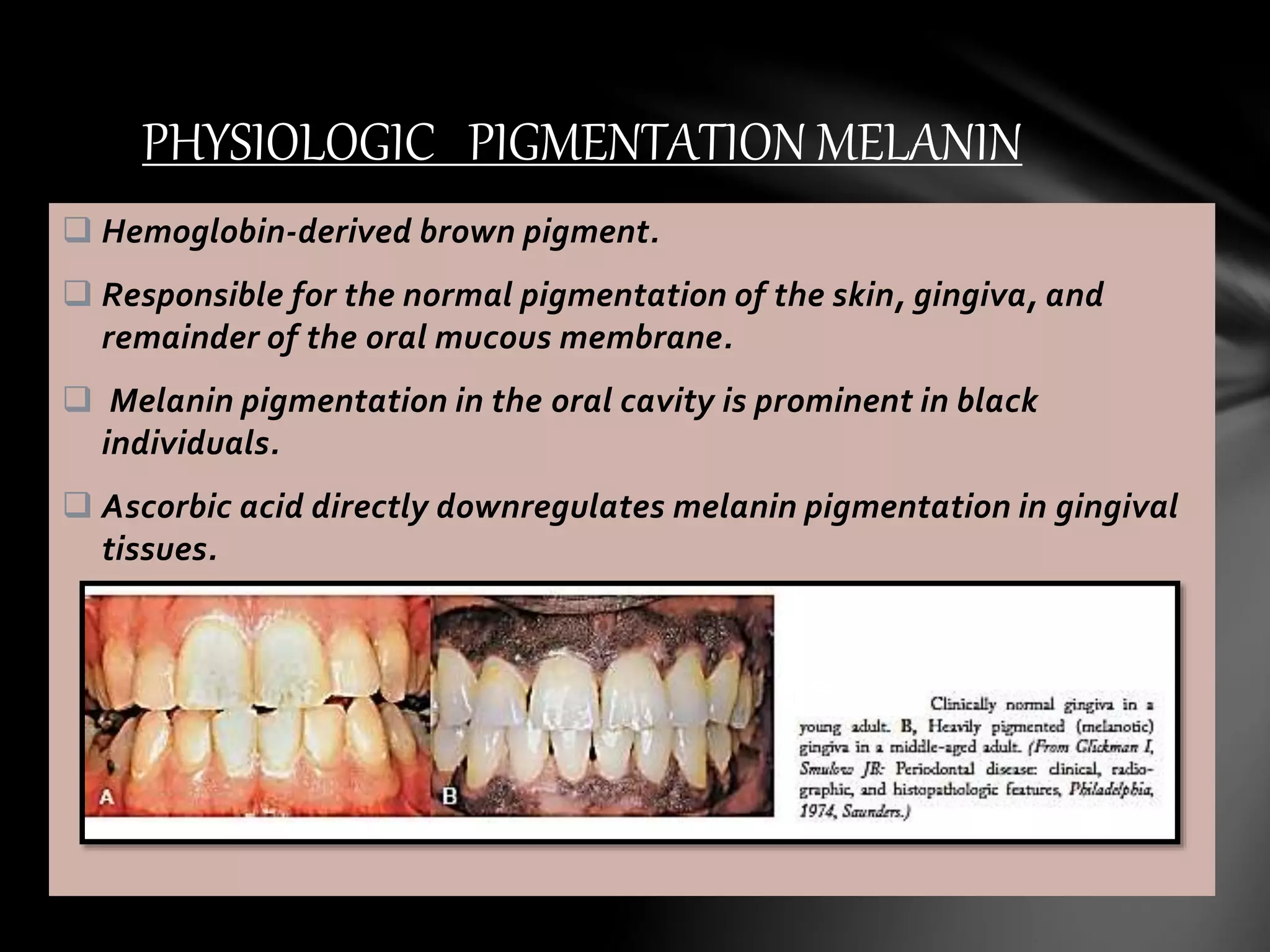 Clinical features and stages of gingivitis | PPT