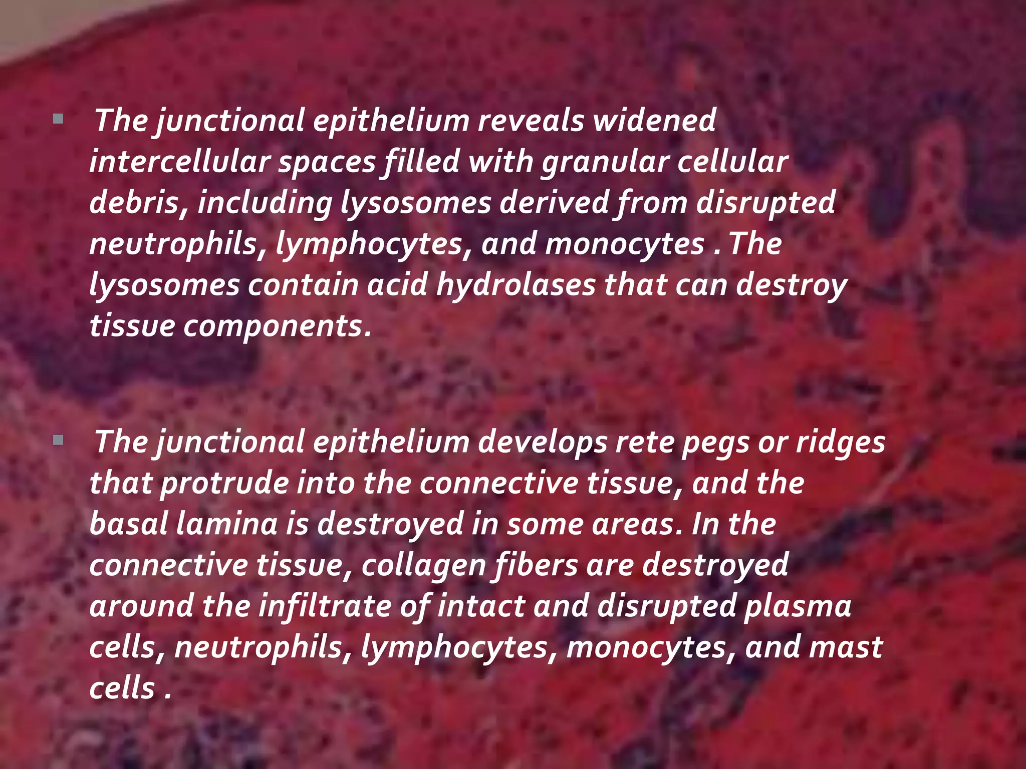 Clinical features and stages of gingivitis | PPTX