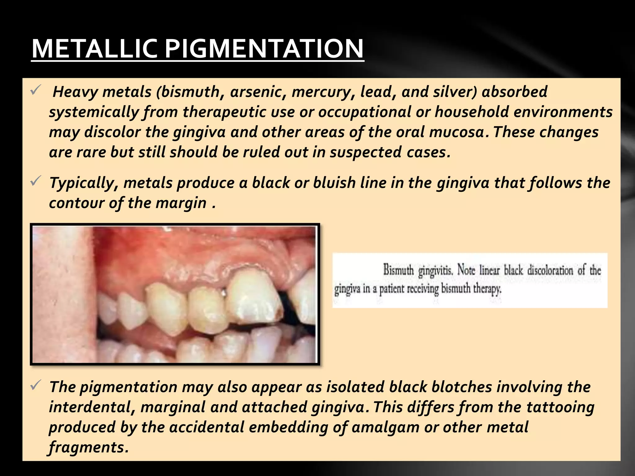 Clinical features and stages of gingivitis | PPTX
