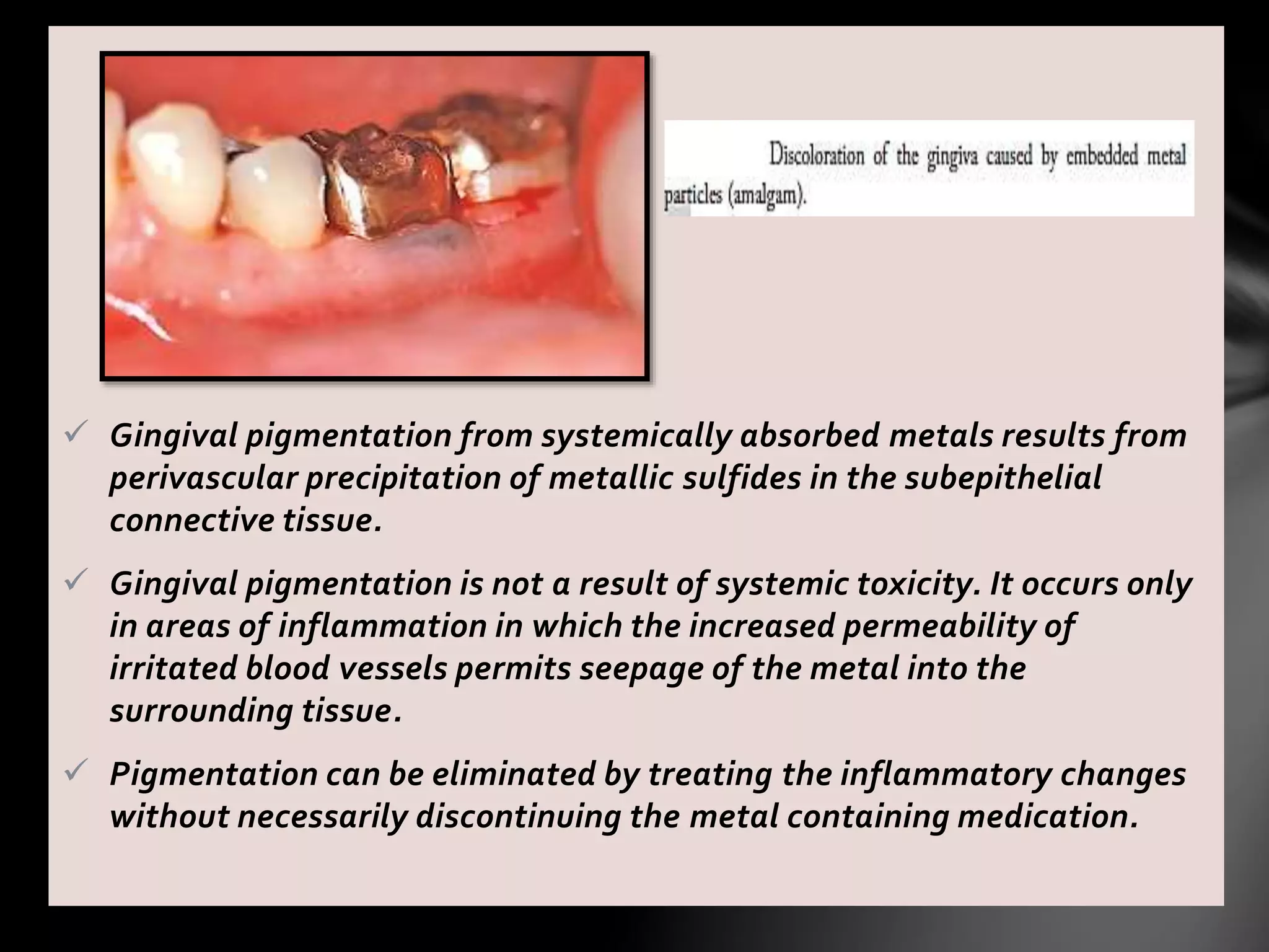Clinical features and stages of gingivitis | PPTX