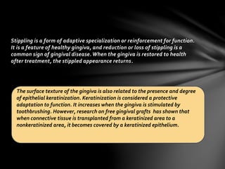Clinical features and stages of gingivitis | PPTX