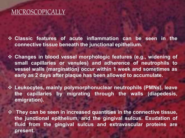 Clinical features and stages of gingivitis | PPTX