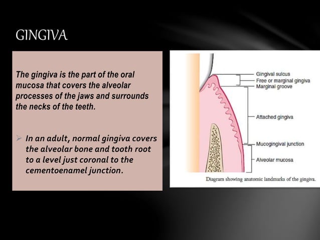 Clinical features and stages of gingivitis | PPTX